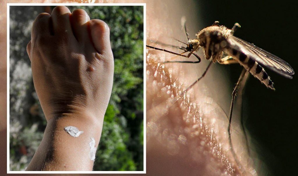 Mosquito bites: 4 signs you’ve been bitten and the best ‘natural ...